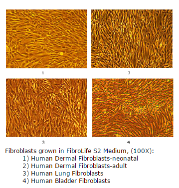 Fibroblasts – Somata